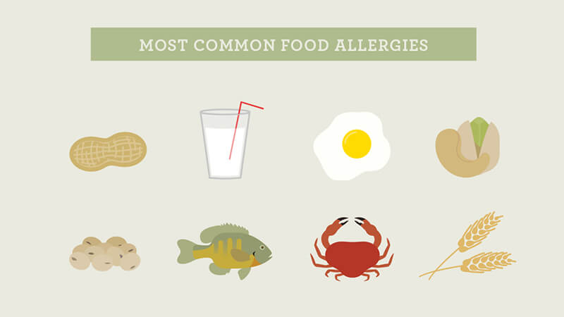 Food Allergies Fact Sheet [Infographic] | Northwestern Medicine