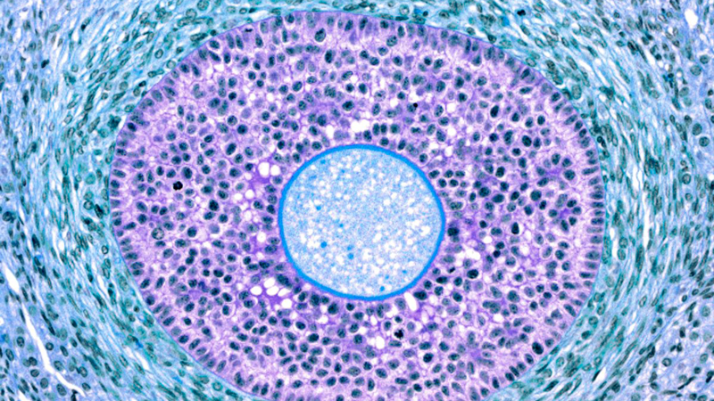 Ovary Transplants Lead Way to Restore Fertility After Cancer ...